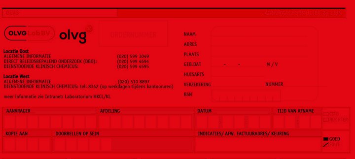 Bloedafname aan huis - OLVG Lab BV